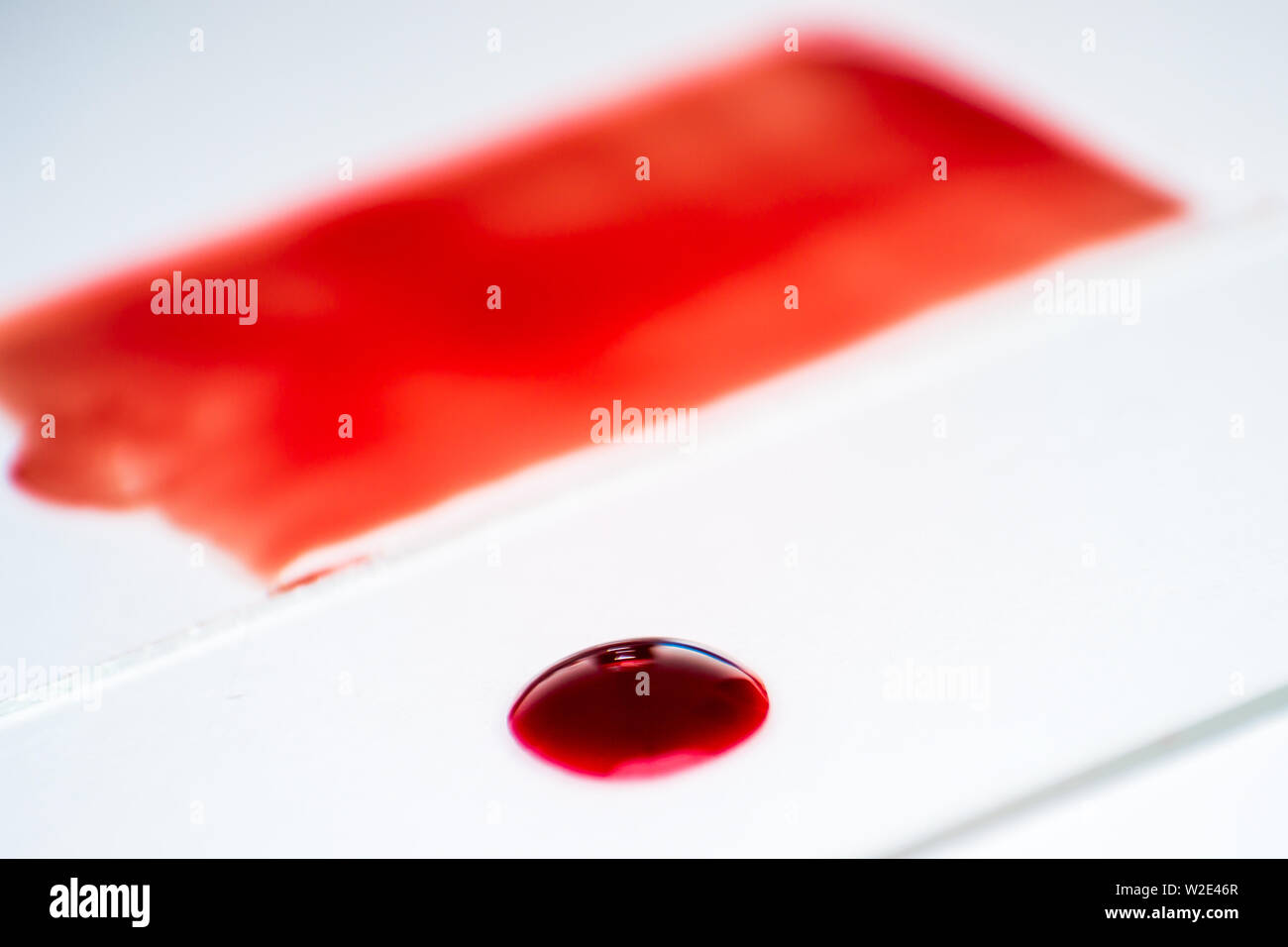 Blood smear for hematology microscopic examination Stock Photo - Alamy