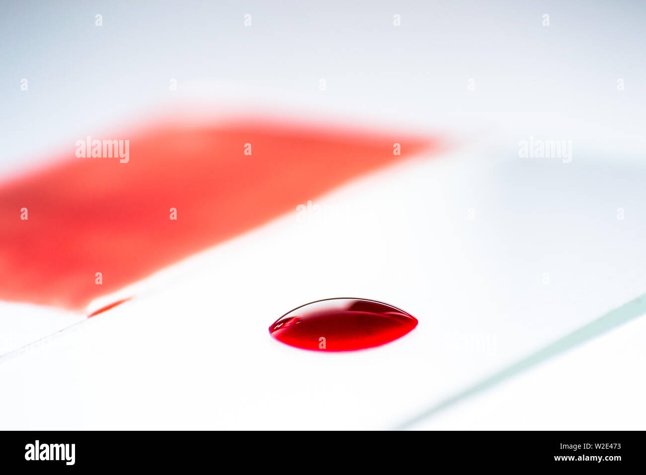 Blood smear for hematology microscopic examination Stock Photo - Alamy