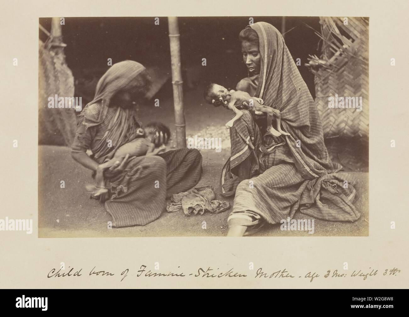 Child Born of Famine-Stricken Mother by WW Hooper, 1877 Stock Photo - Alamy
