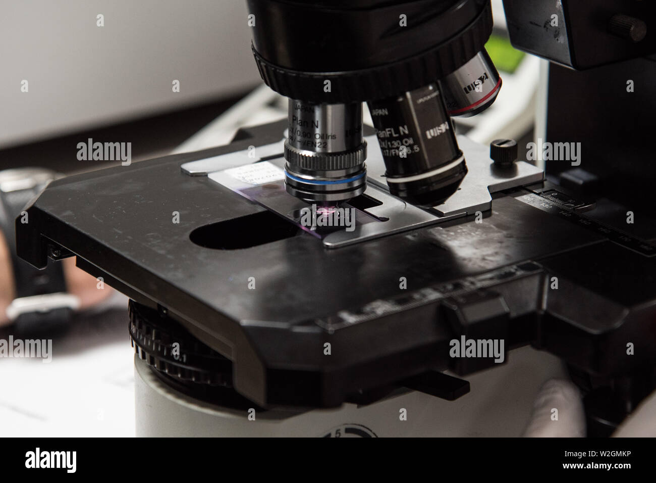 A microscope is used to observe a blood sample July 8, 2019, at ...