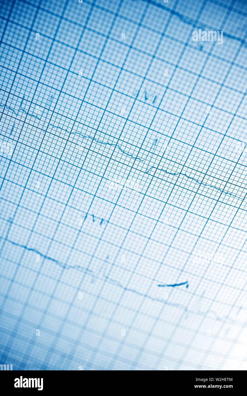 Close up of an electrocardiogram in paper form Stock Photo - Alamy