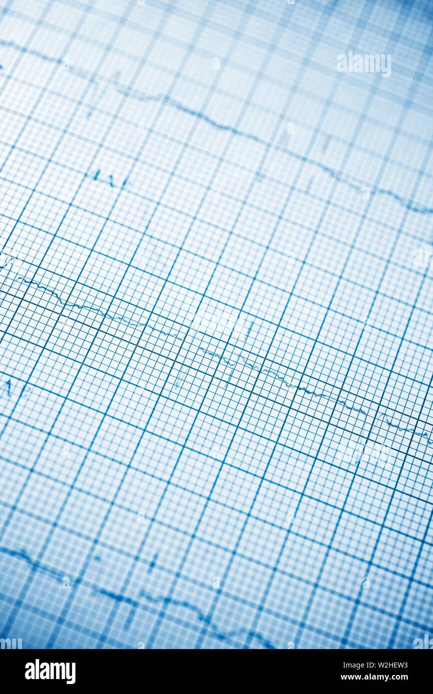 Close up of an electrocardiogram in paper form Stock Photo - Alamy