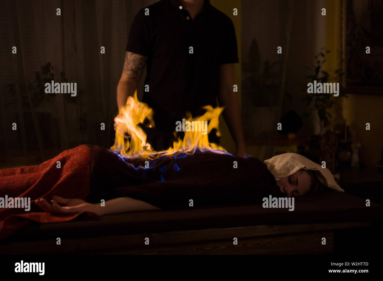 Chinese fire massage and therapy Stock Photo - Alamy