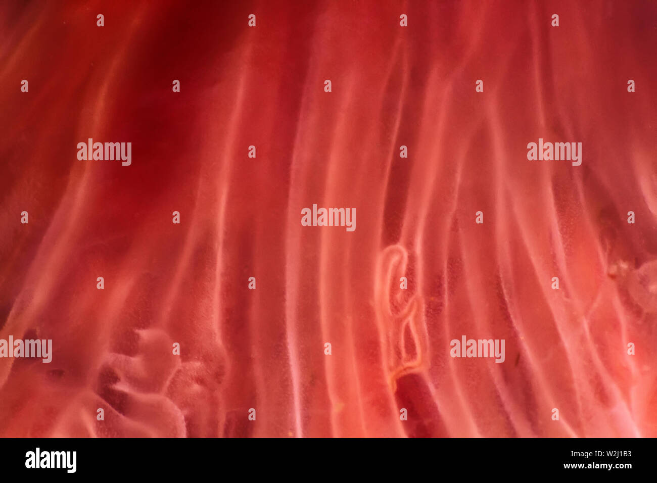 Gastrodermis hi-res stock photography and images - Alamy