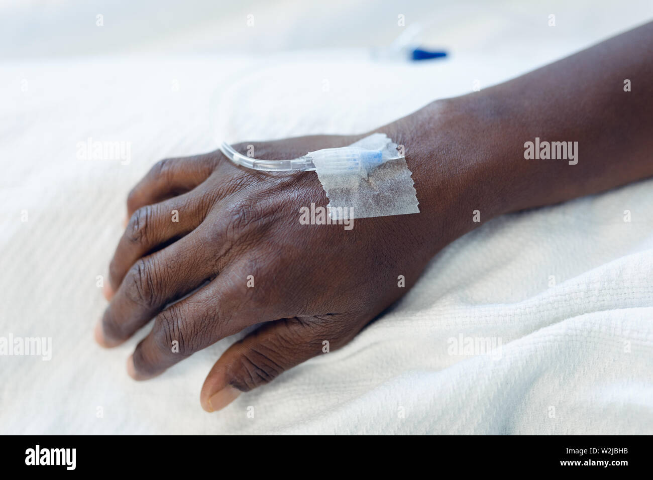 IV drip on a patient hand in the ward at hospital Stock Photo - Alamy
