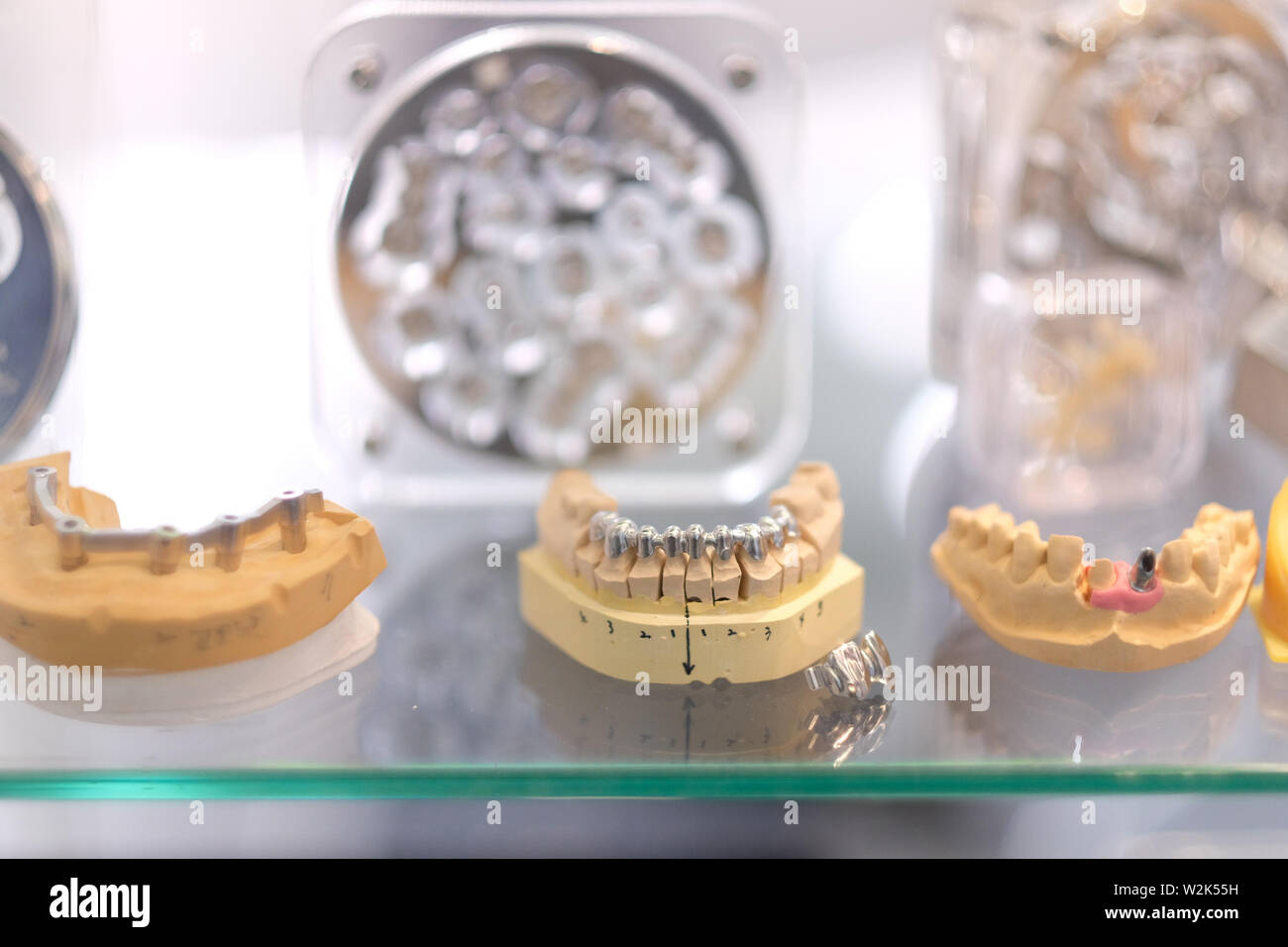 Samples of tooth crowns and implants for prosthetics at the dental ...