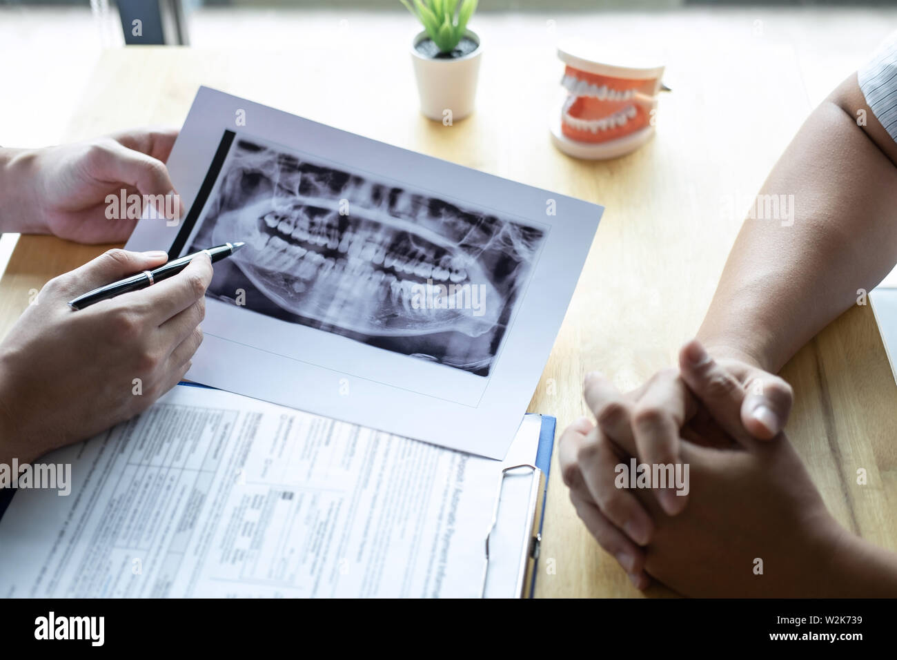 Image of doctor or dentist presenting with tooth x-ray film recommend ...