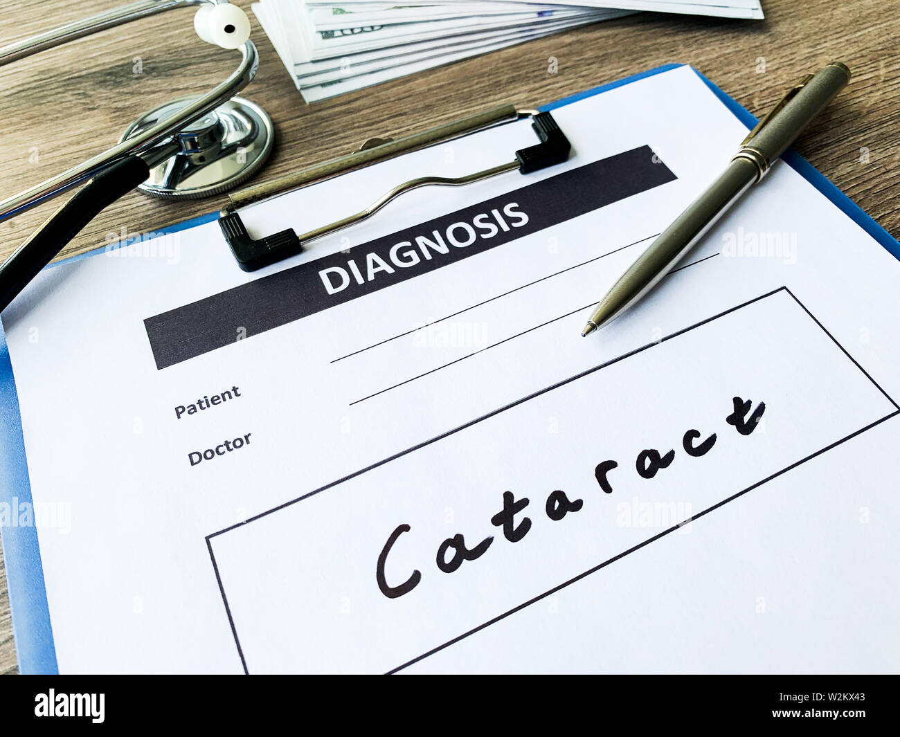 Diagnosis cataract in a medical form on the doctor desk Stock Photo - Alamy