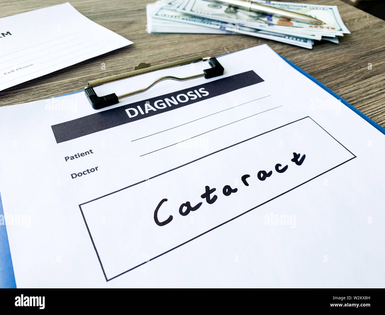 Diagnosis cataract in a medical form on the doctor desk Stock Photo - Alamy