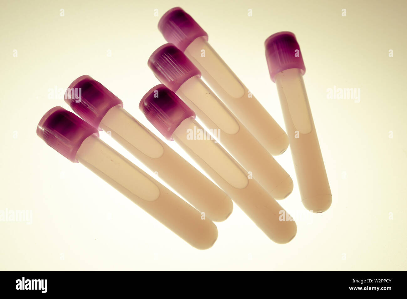 Test tubes with samples of biomaterials Stock Photo - Alamy