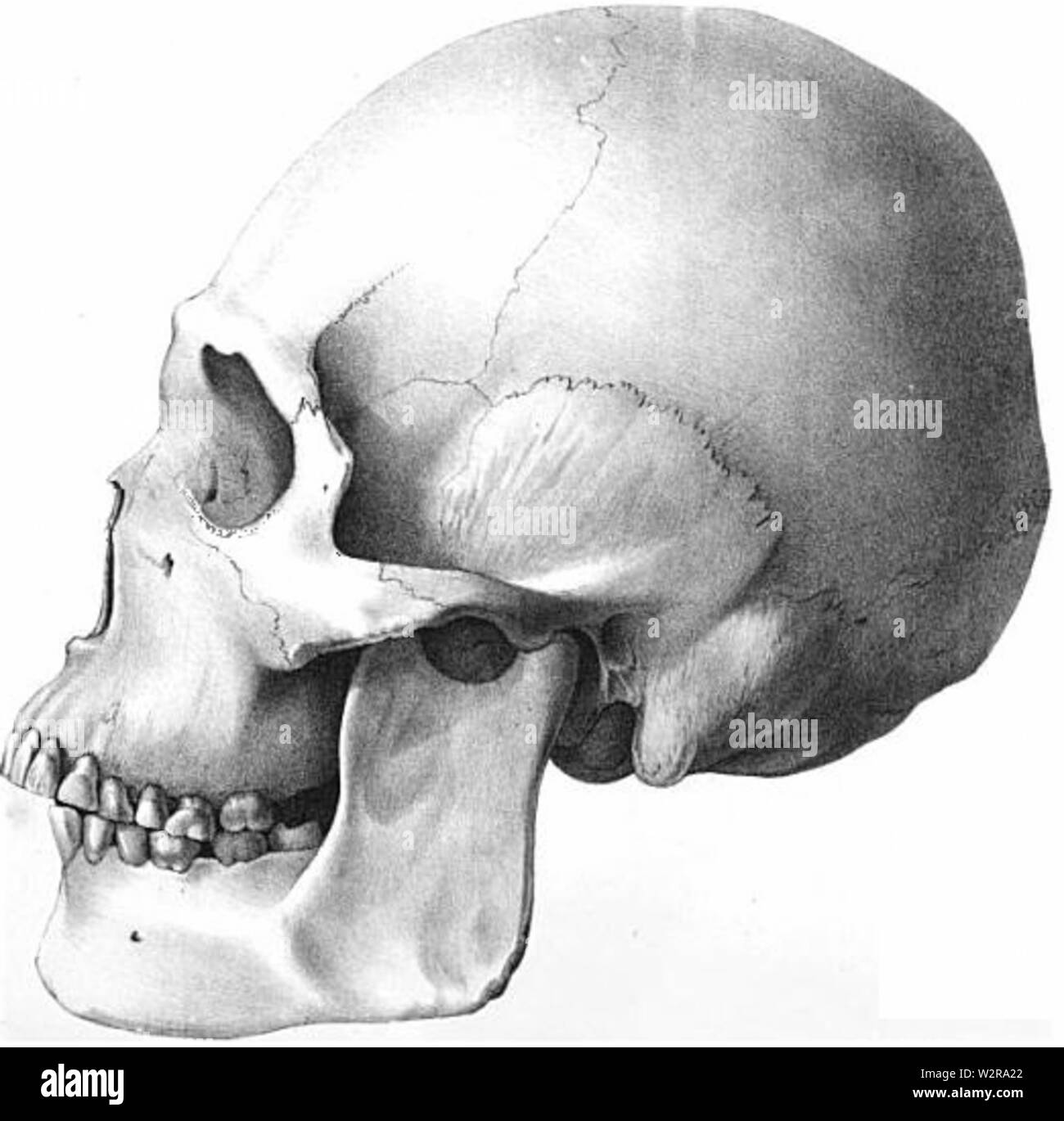 Mongoloid Skull Side