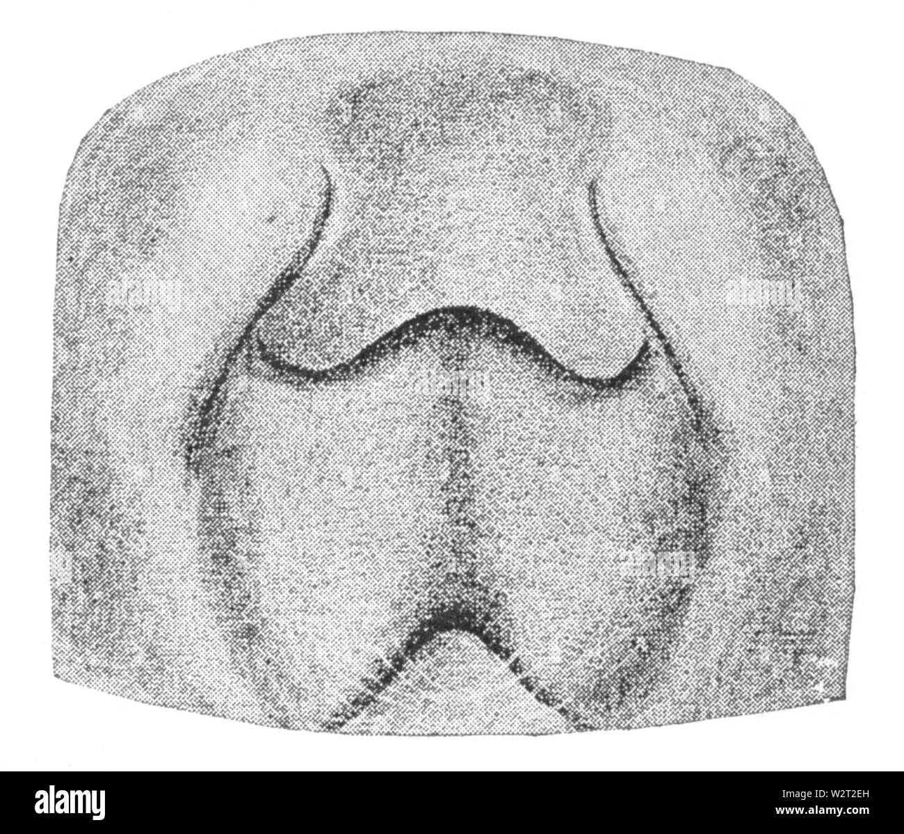 Comstock Zygoballus epigyne Stock Photo - Alamy