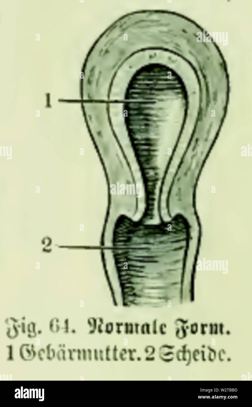 Die Frau als Hausärztin (1911) 064 Normale Form der Gebärmutter Stock ...