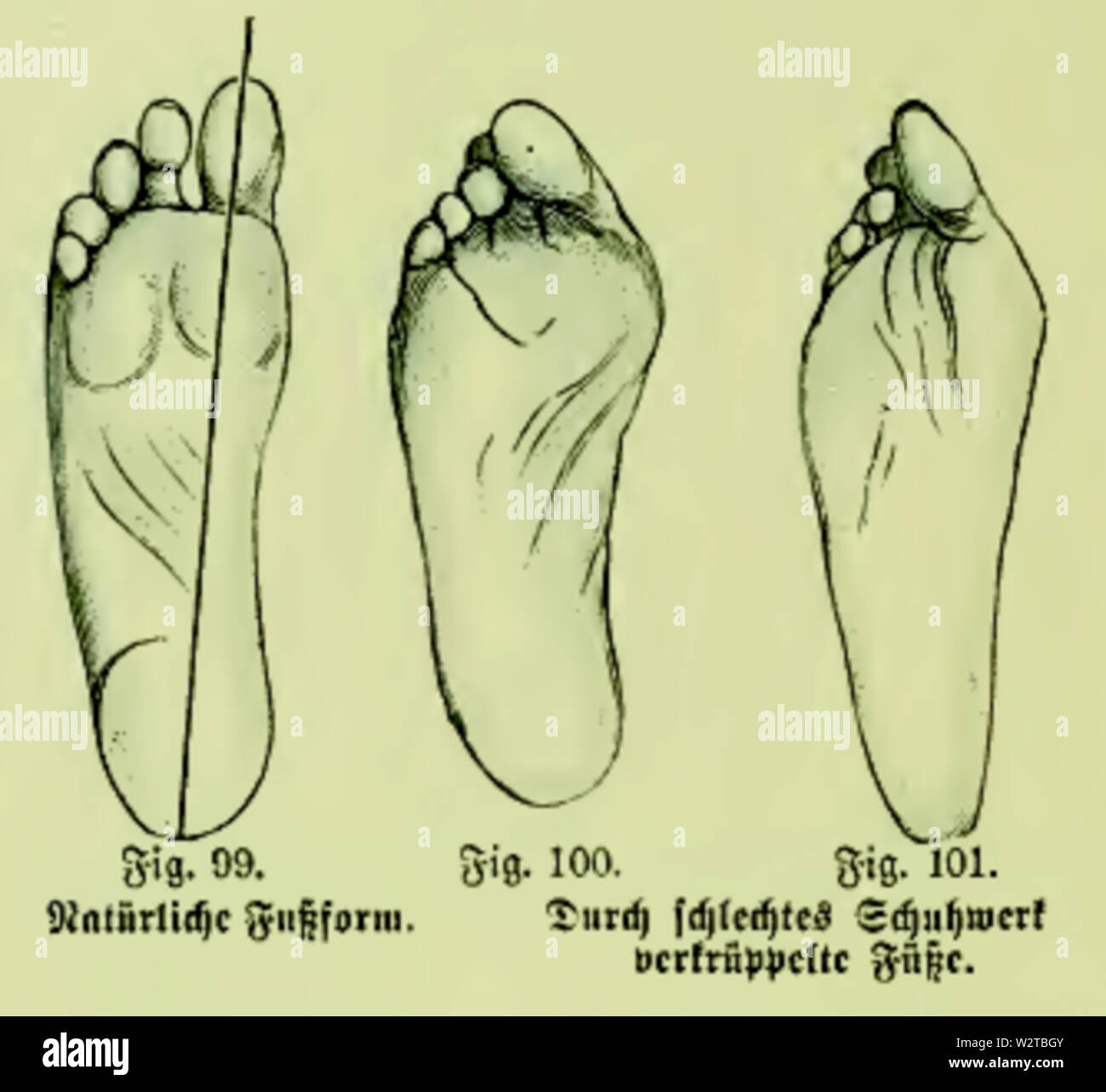 Die Frau als Hausärztin (1911) 100 102 Fußformen Stock Photo - Alamy