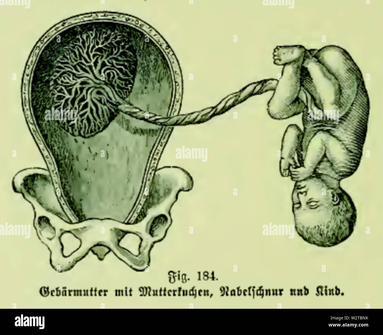Die Frau als Hausärztin (1911) 184 Gebärmutter mit Mutterkuchen ...