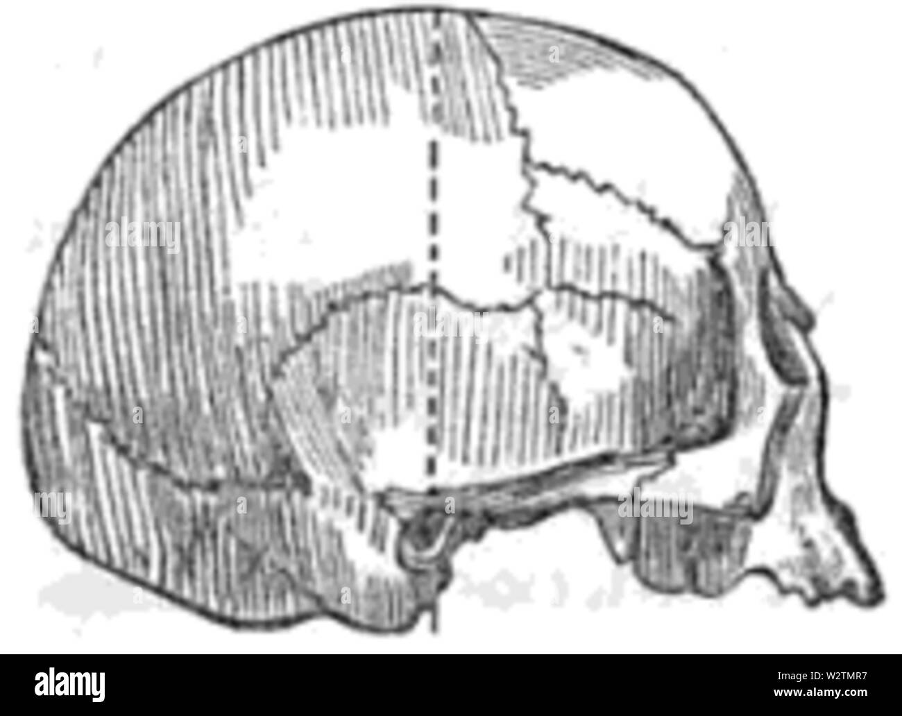 Eskimo skull Mongoloid 3 Stock Photo - Alamy