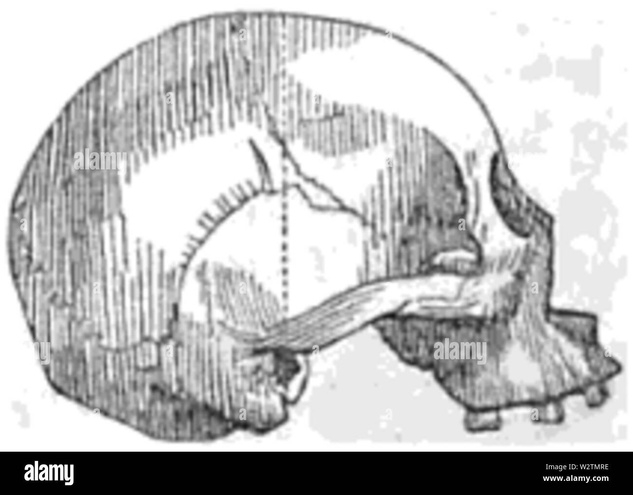 Eskimo skull Mongoloid 4 Stock Photo - Alamy