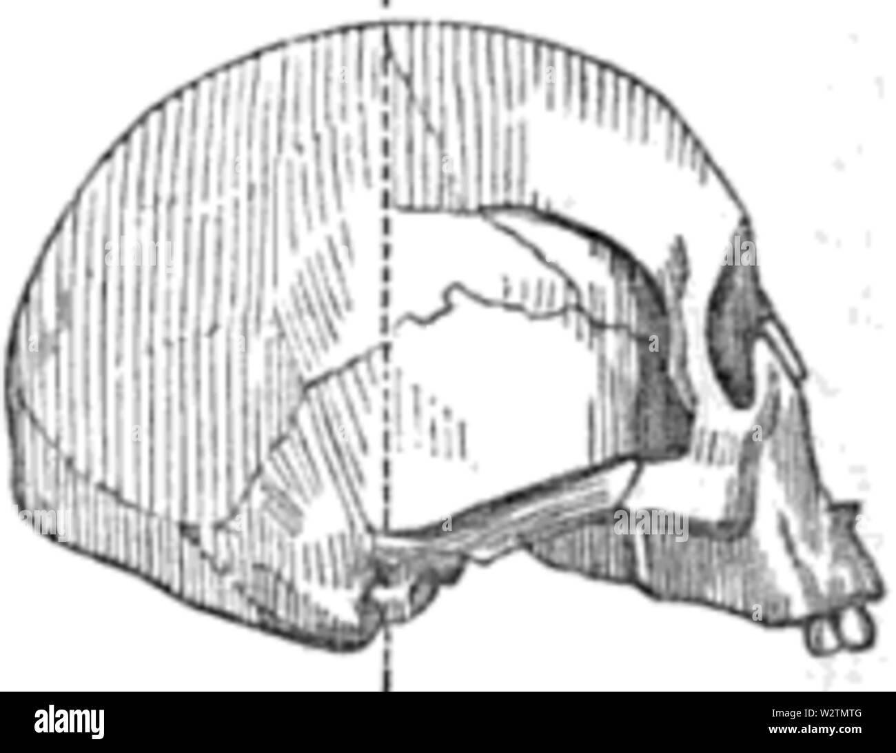 Eskimo skull Mongoloid 2 Stock Photo - Alamy