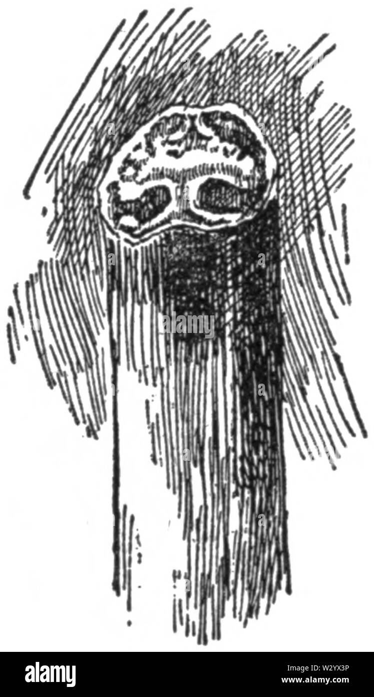 Organ cross section Black and White Stock Photos & Images - Alamy