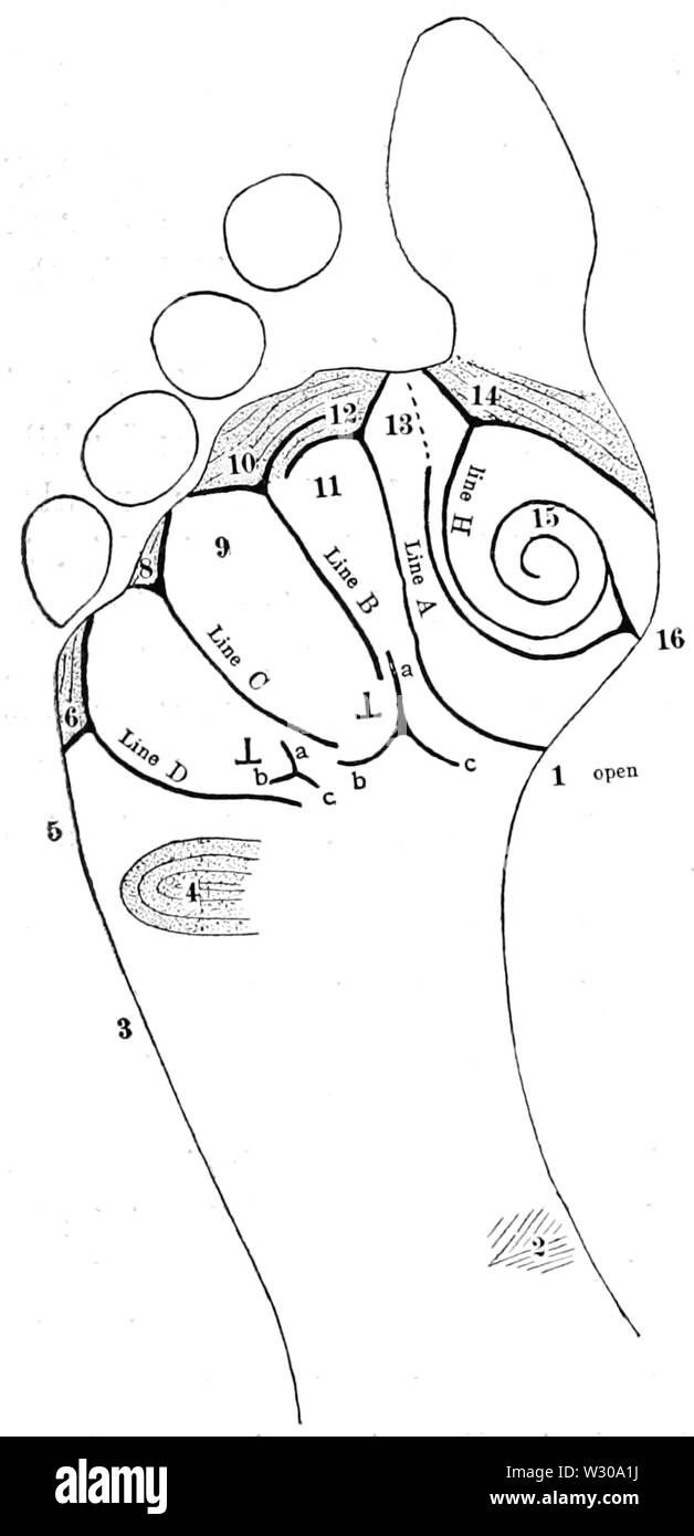 PSM V63 D412 Left sole tracing with descriptive interpretation Stock ...