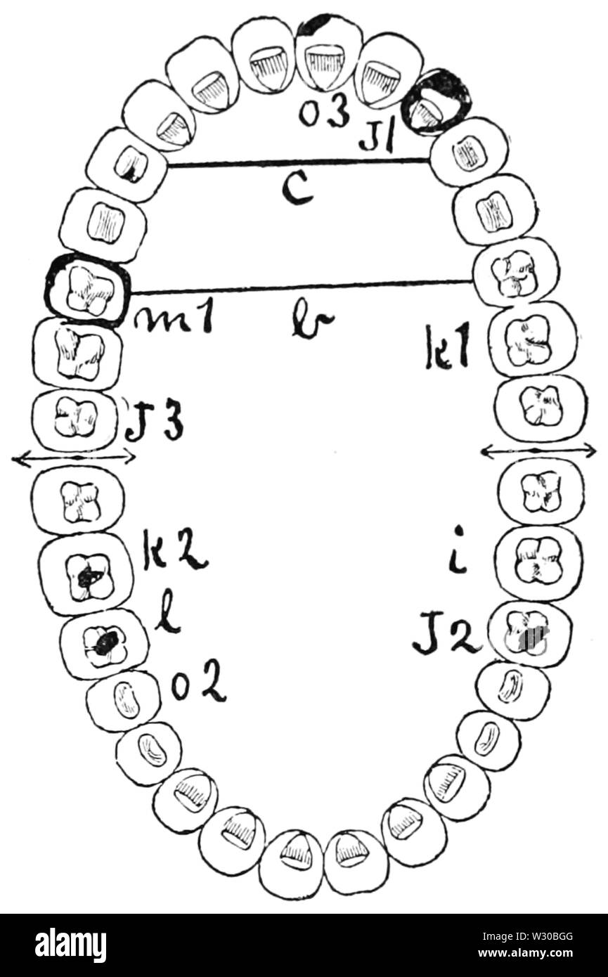 Mouth teeth diagram hi-res stock photography and images - Alamy