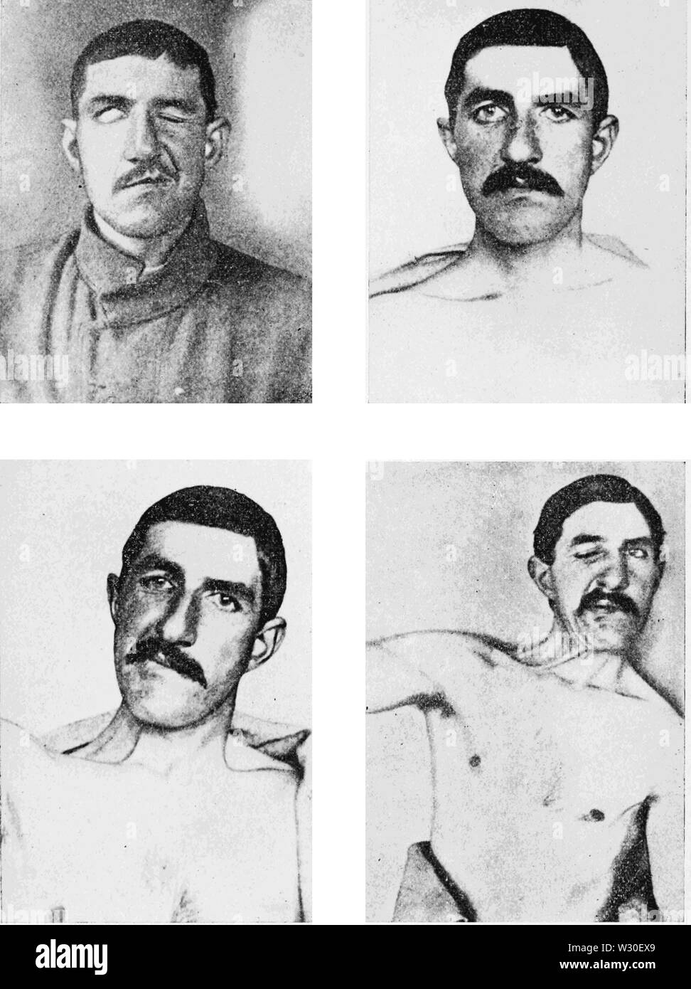 Involuntary twitching hi-res stock photography and images - Alamy