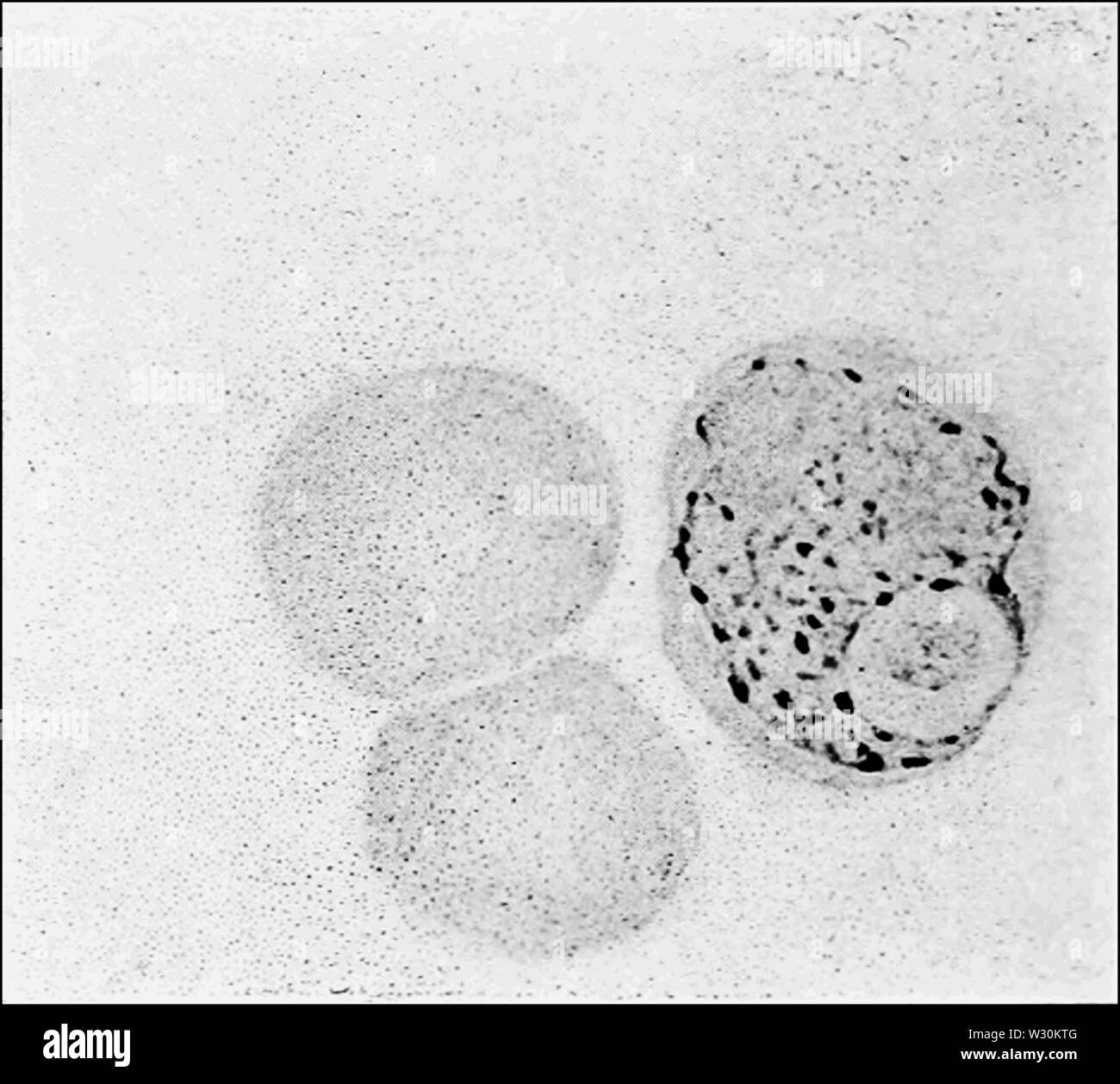 Malarial Black and White Stock Photos & Images - Alamy