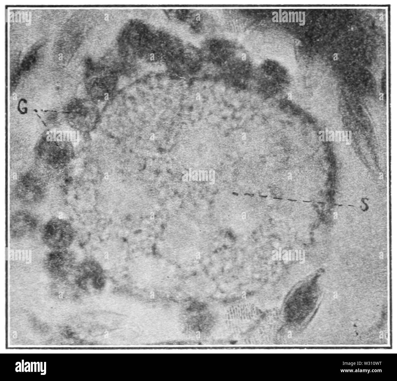 Monocystis hi-res stock photography and images - Alamy