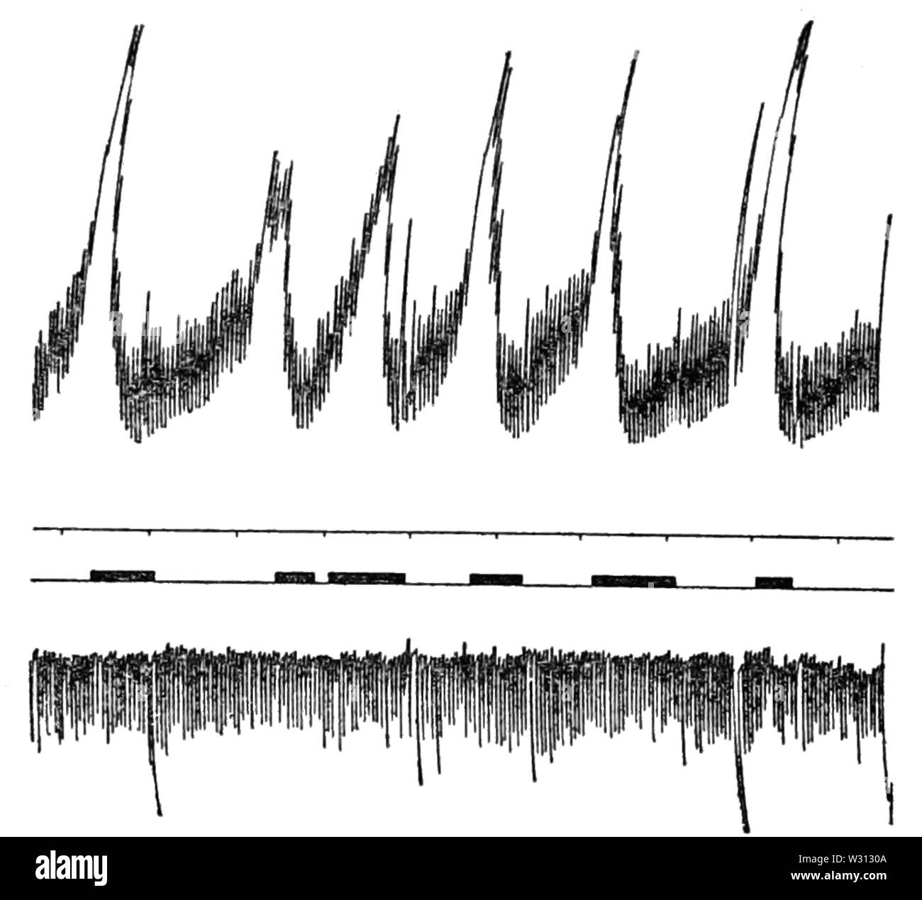 Pneumograph High Resolution Stock Photography and Images - Alamy