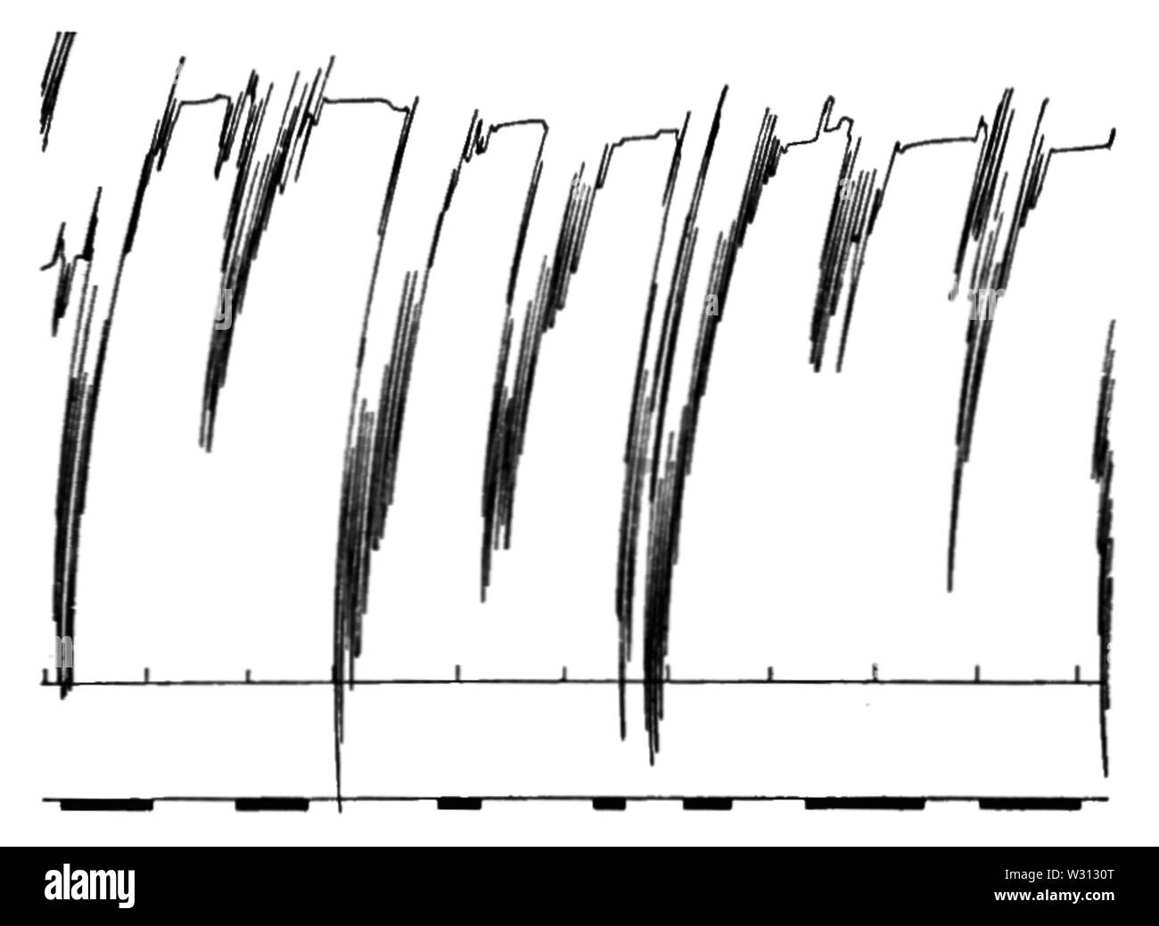 PSM V81 D311 Oscillations of the esophagus by a pneumograph Stock Photo ...