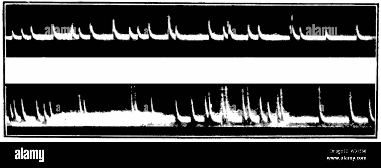 PSM V87 D123 String electrometer record of beta on top and alpha ...