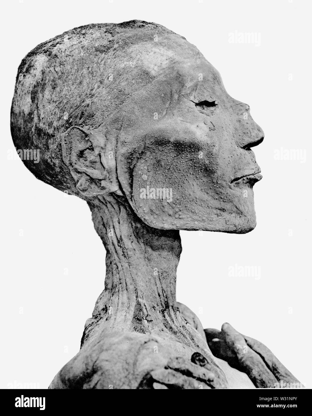 Ramses V mummy head Stock Photo - Alamy