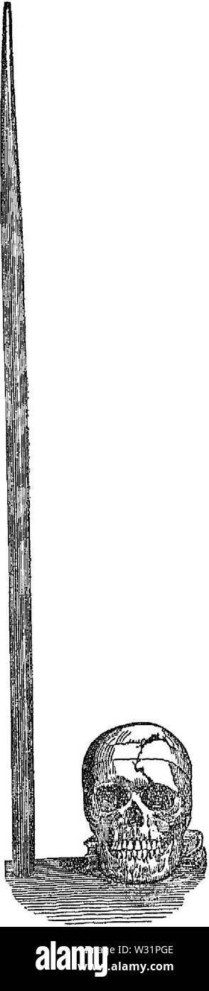 Recovery from the passage of an iron bar through the head figure 01 ...