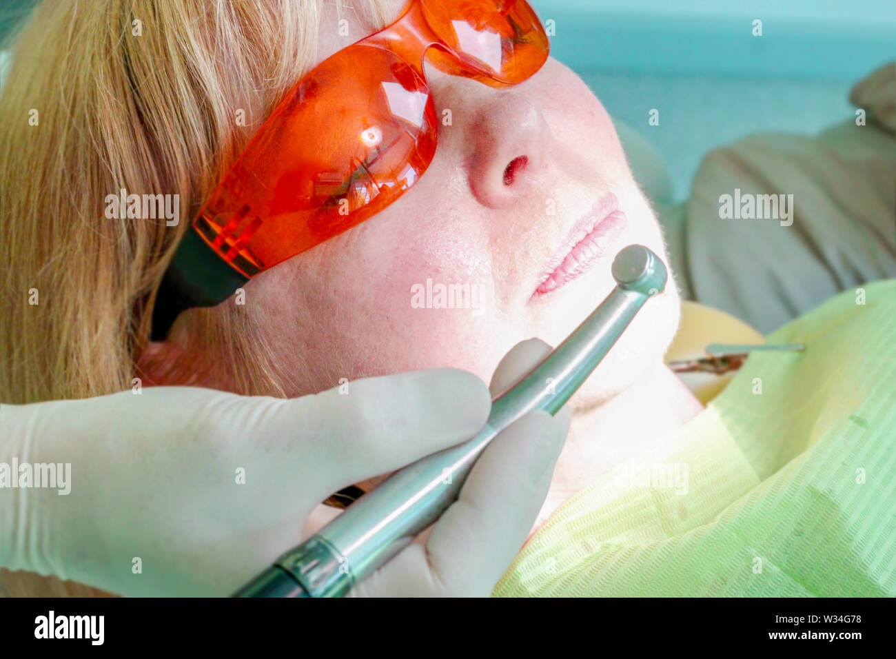 Drilling teeth hi-res stock photography and images - Alamy