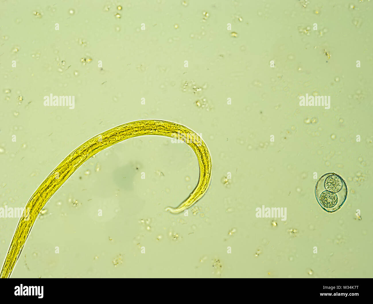 Isospora felis hi-res stock photography and images - Alamy
