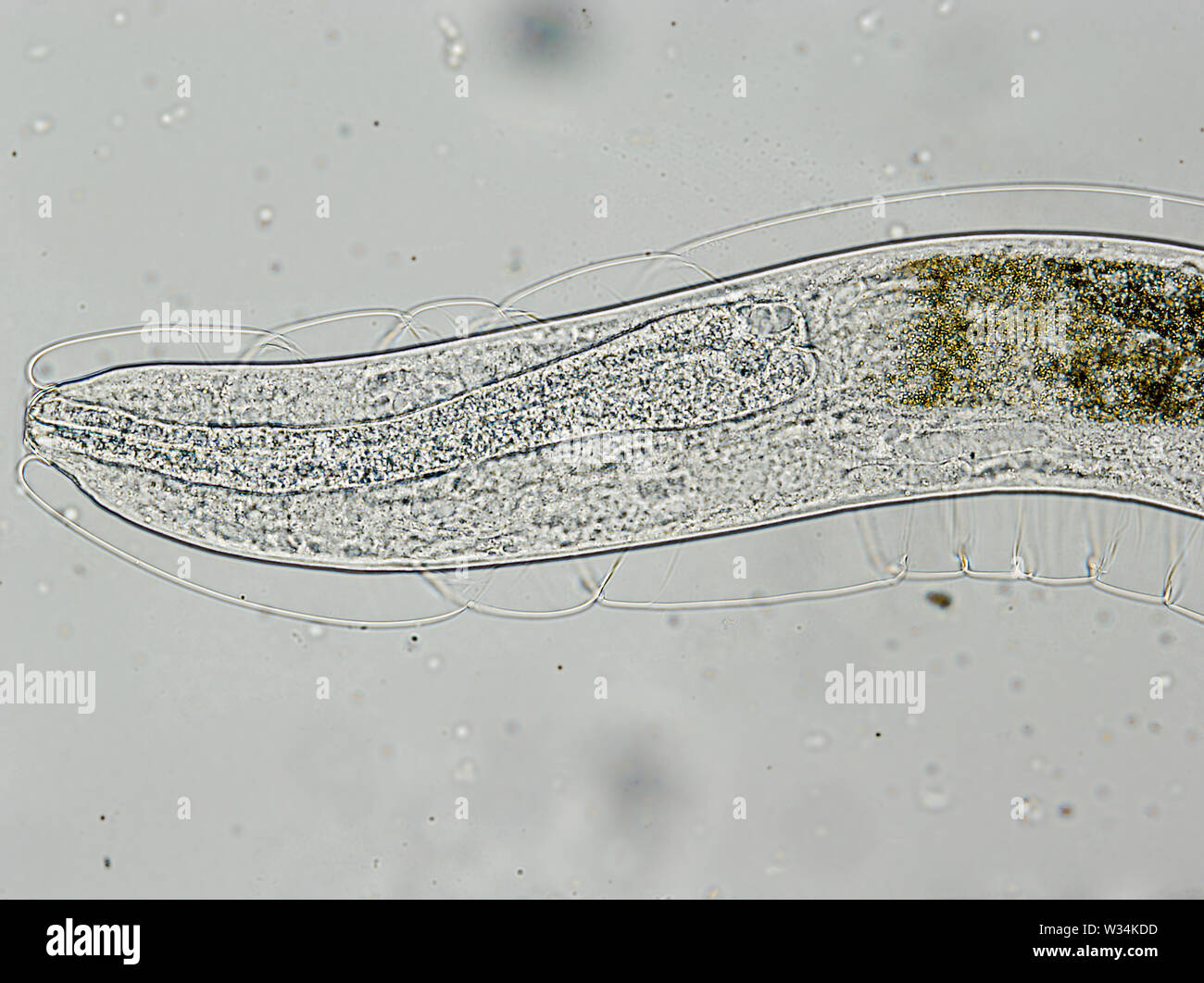 Lungworm hi-res stock photography and images - Alamy
