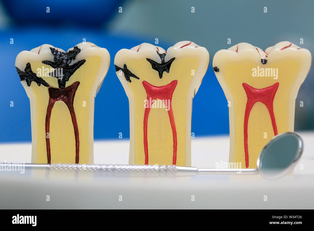 White teeth and dental instruments Stock Photo - Alamy