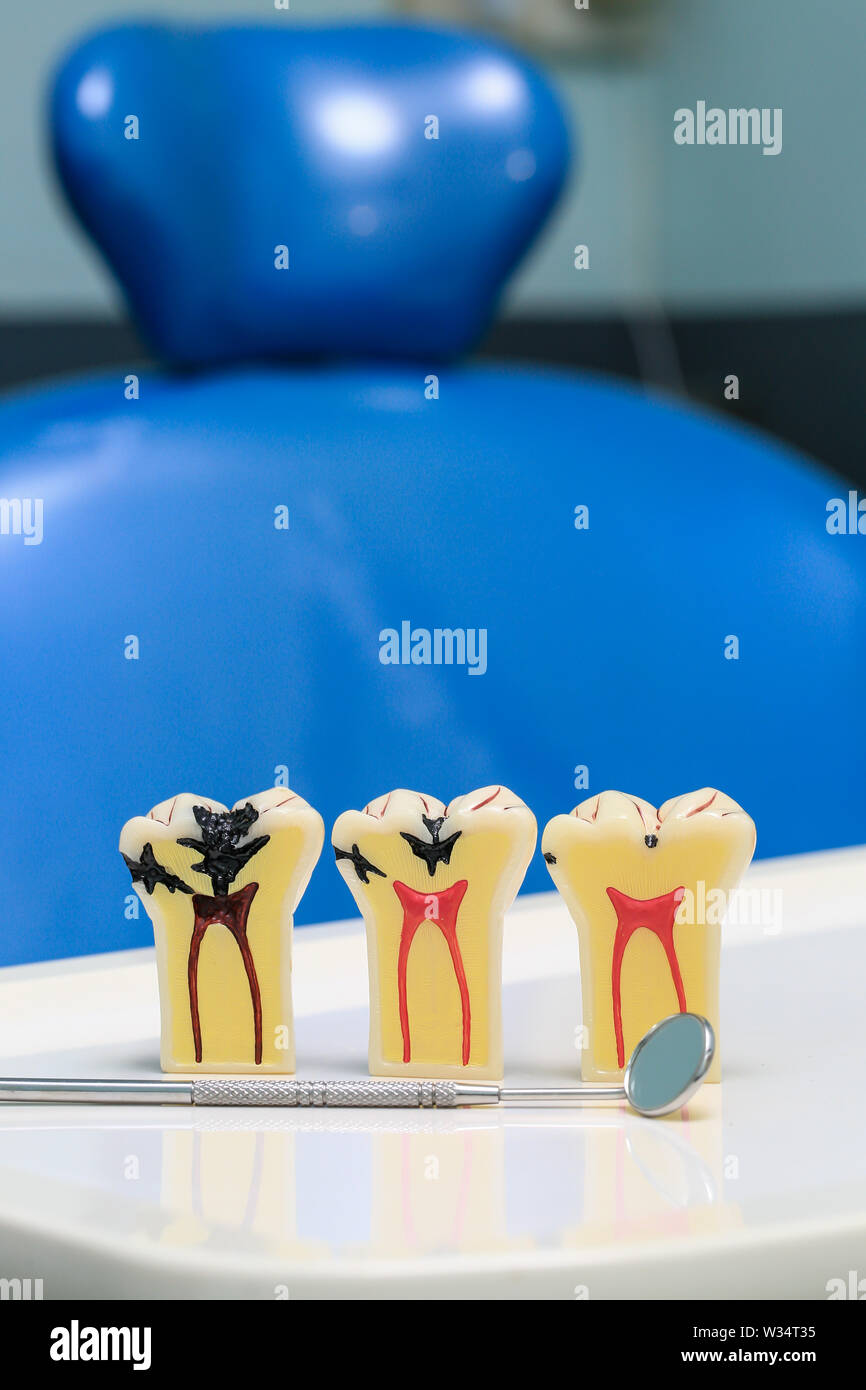 White teeth and dental instruments Stock Photo - Alamy