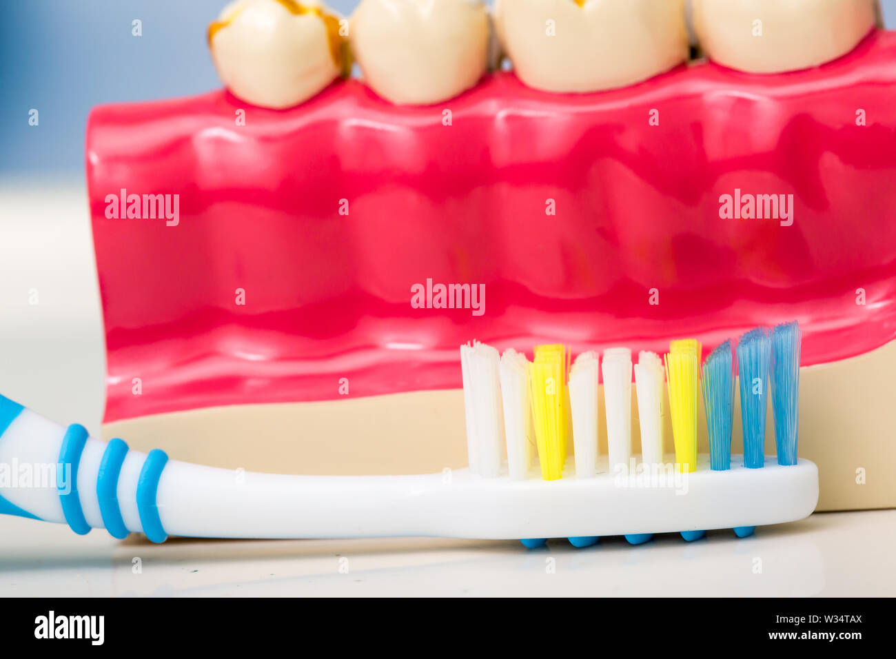 Orthodontic sample hi-res stock photography and images - Alamy