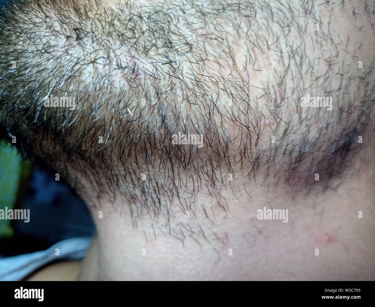 Bearded young man, stubble near. Unshaven more than a week. Hair on the ...