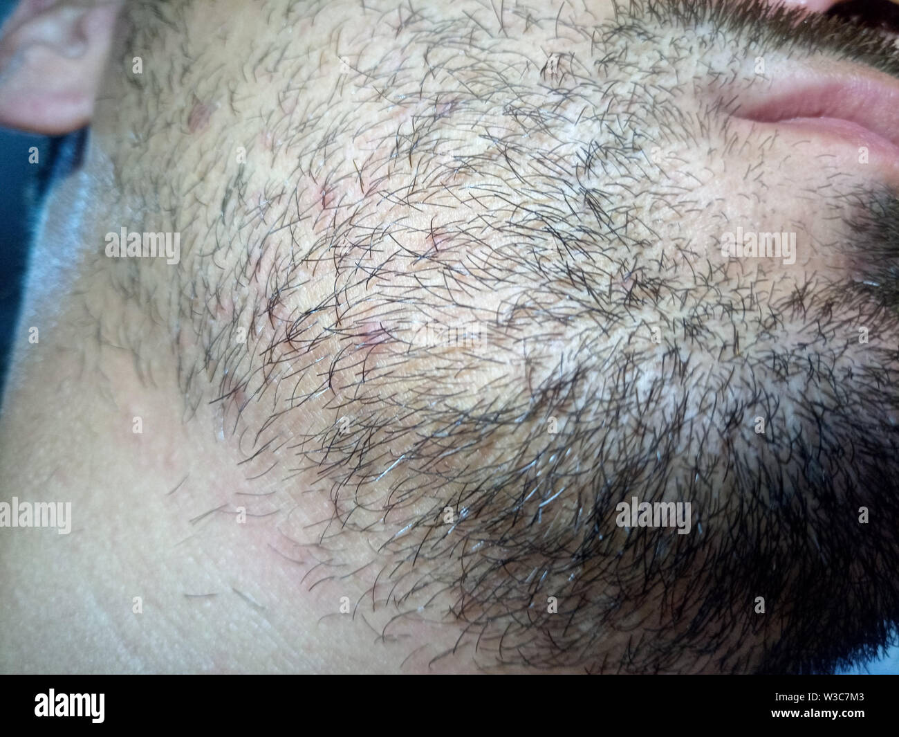 Bearded young man, stubble near. Unshaven more than a week. Hair on the ...