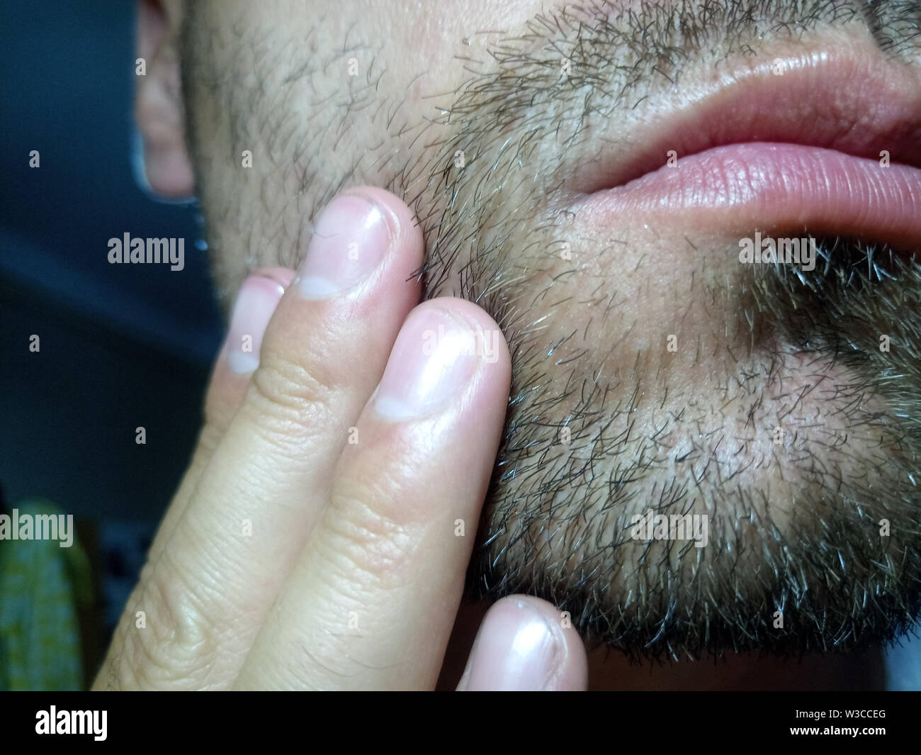 Bearded young man, stubble near. Unshaven more than a week. Hair on the ...