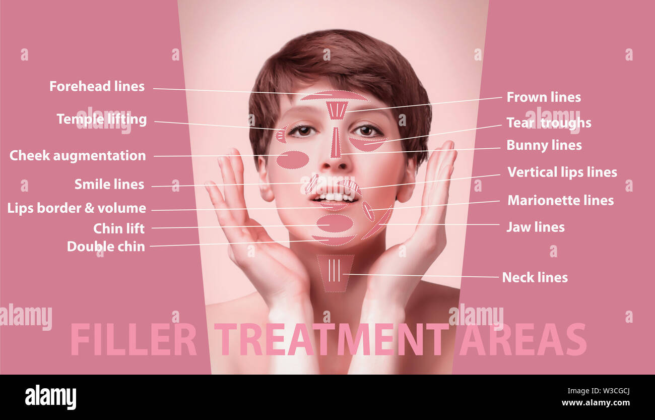 Female face and areas for rejuvenation cosmetological injections Stock ...