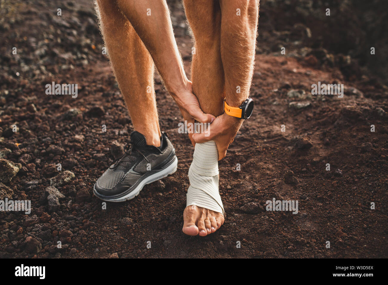 Male runner holding injured leg close-up and suffering with pain. Leg ...