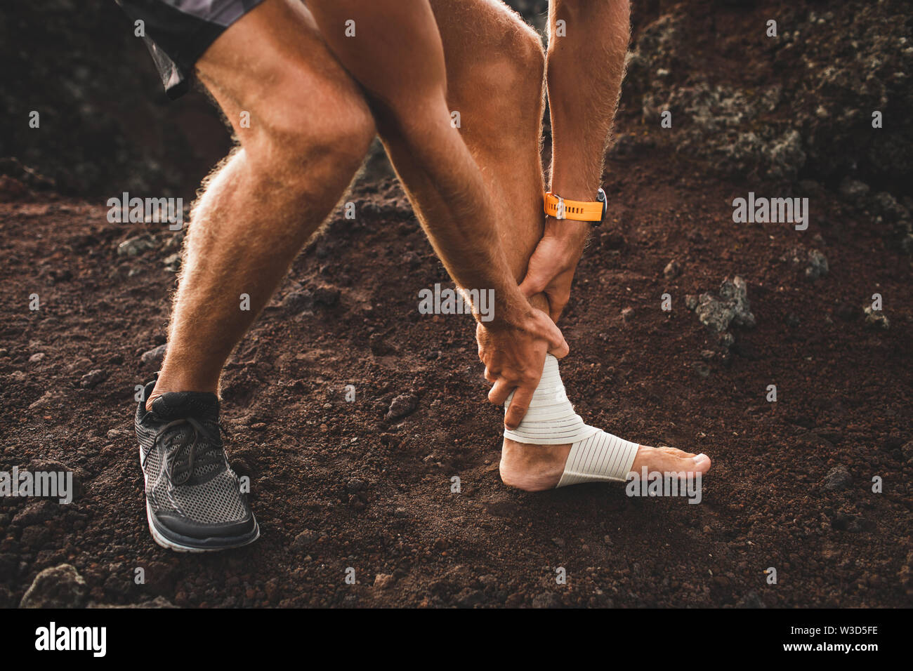 Male runner holding injured leg close-up and suffering with pain. Leg ...