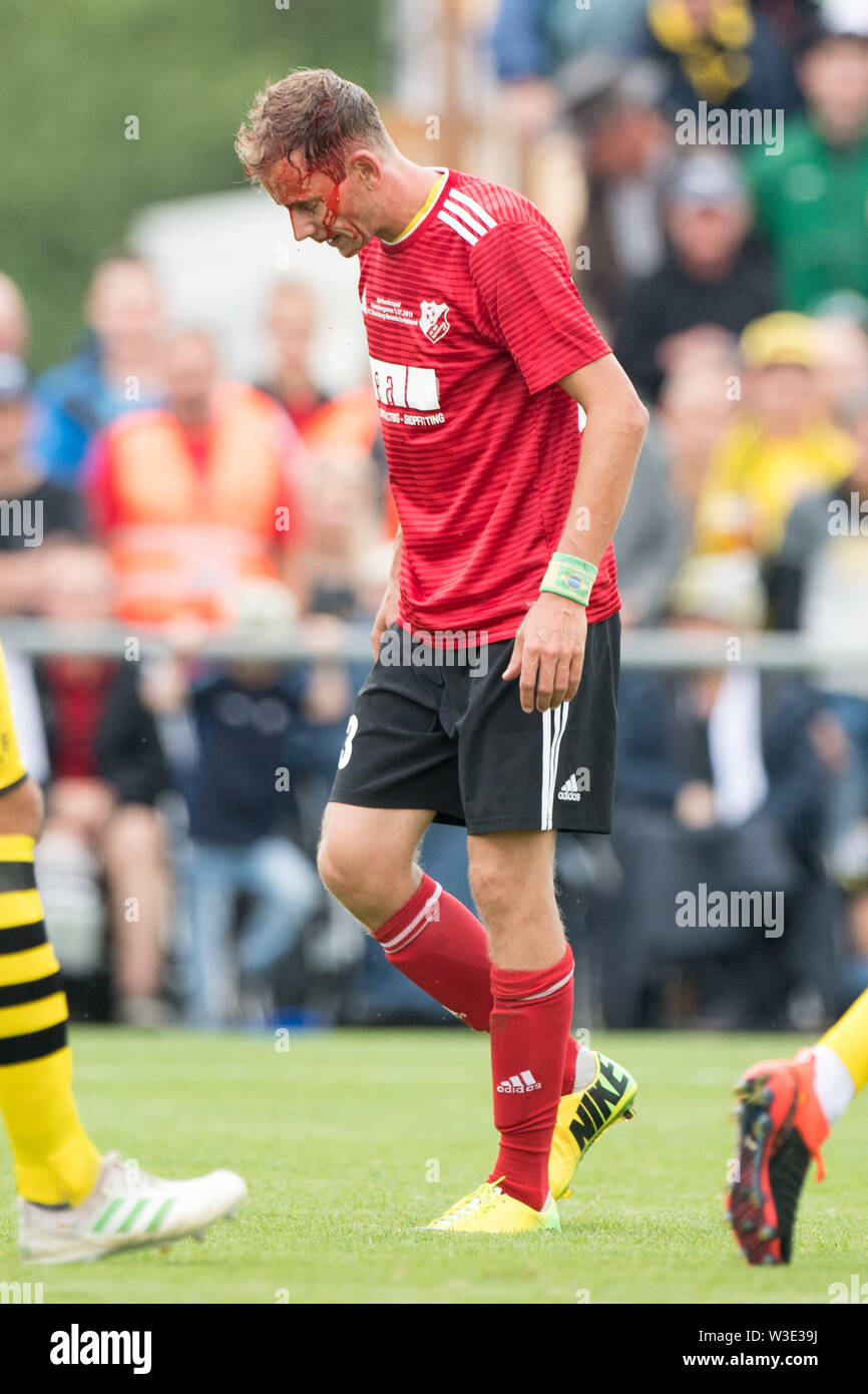 Soccer Football Blood Bleeding High Resolution Stock Photography and ...