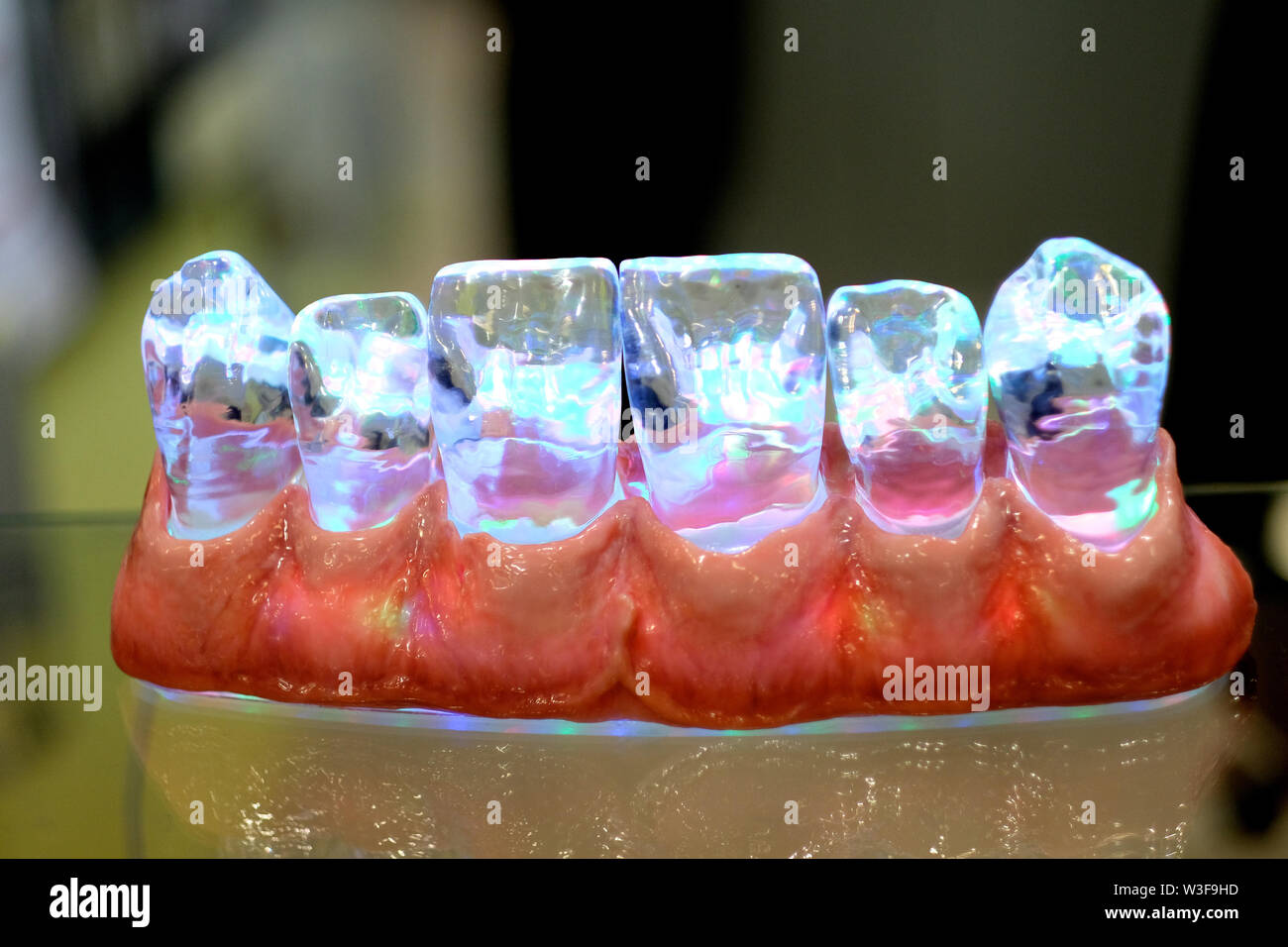 A model of a person's jaw on the display stand of a dental exhibition ...