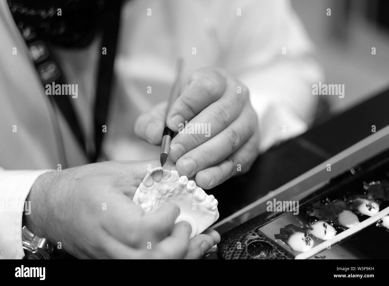 Making an individual tooth crown in a denture laboratory Stock Photo ...