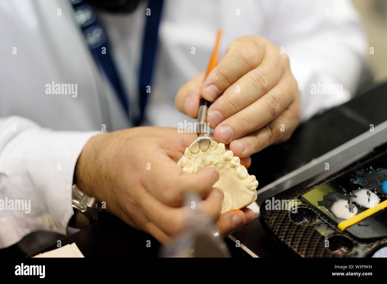 Making an individual tooth crown in a denture laboratory Stock Photo ...