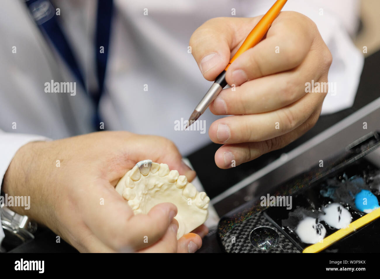 Working with the cast of the jaw in the manufacture of a prosthesis in ...
